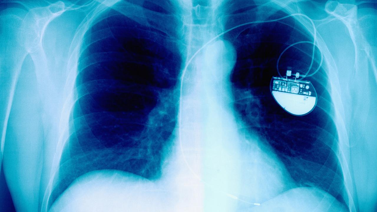 Why implantable medical devices are a big test for regulators ...