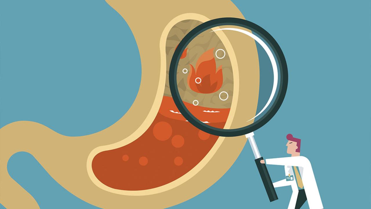 What doctors wish patients knew about GERD | American Medical Association