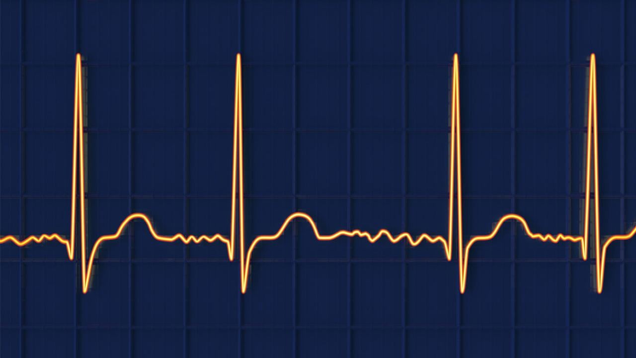 AI-guided mapping aids AFib ablation therapy | American Medical Association