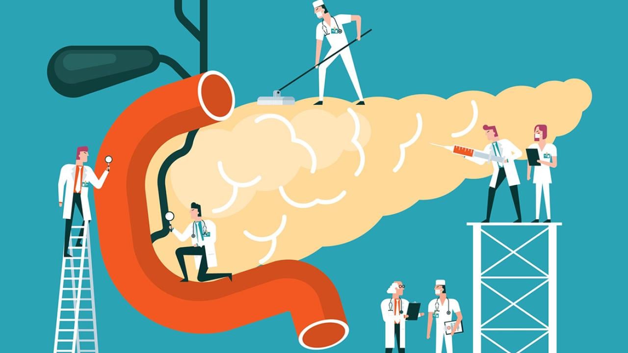 What doctors want patients to know about pancreatic cancer | American ...